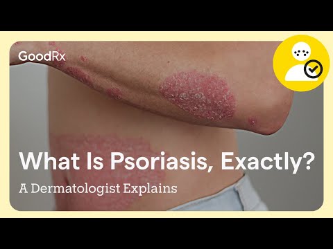 What Is Psoriasis, Exactly? A Dermatologist Explains | GoodRx
