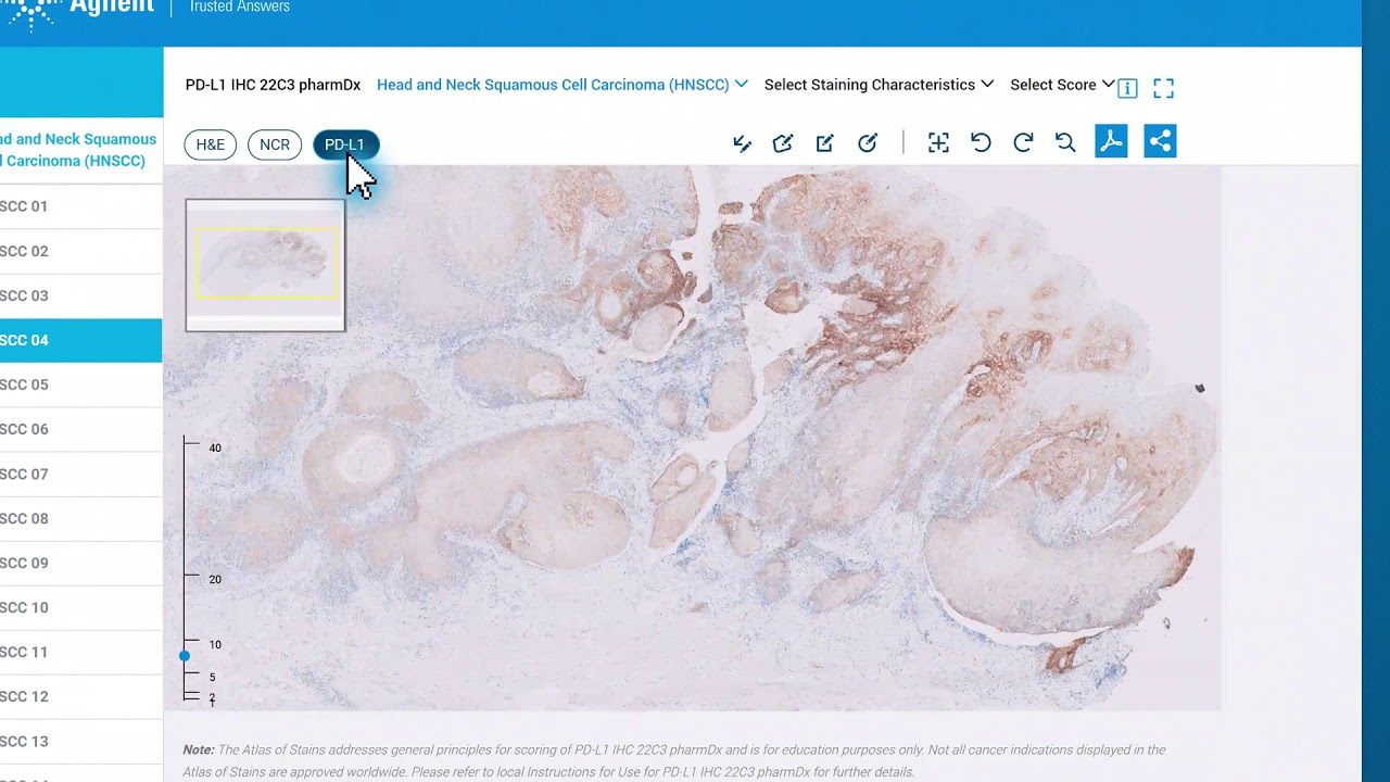 Atlas of Stains for PD-L1 IHC 22C3 pharmDx | A world of PD-L1 Resources Await (Video 4/5)