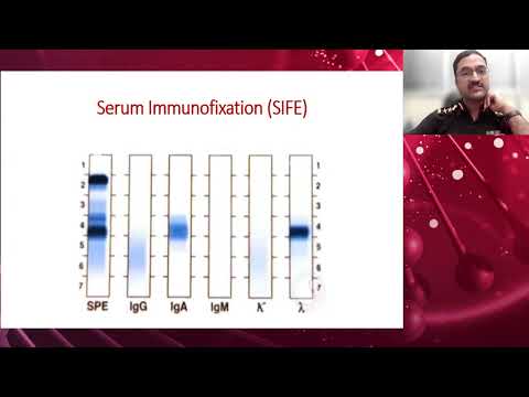 24_M Protein in Blood - Is it Myeloma?_12th April, 2023