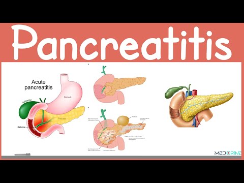 Pankreatitis Akut dan Kronis: Patofisiologi, Presentasi, Diagnosis dan Penatalaksanaan yang Mudah