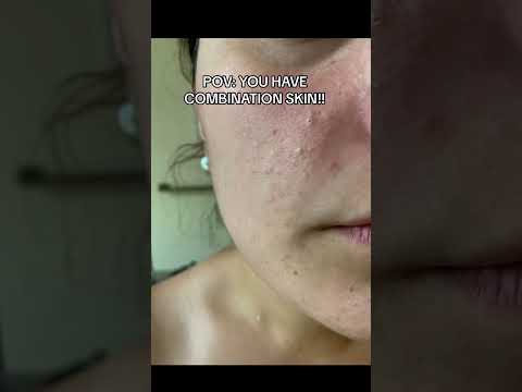 Do you have COMBINATION SKIN?! #skincare #skincareroutine