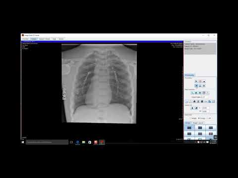 View Patient CD in ImageSuite