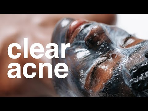 Acne Clearing Facial - C202 by Circadia