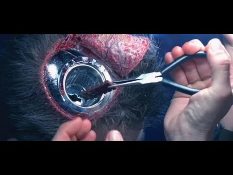 First Aid Operation Brain Chip- Terminator 2 Judgement Day (1991) - Movie Clip 4K HD Scene