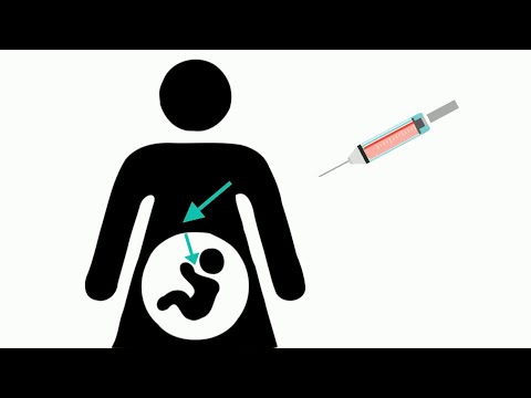 Example Preemie Prep for Parents Video About Antenatal Corticosteroids