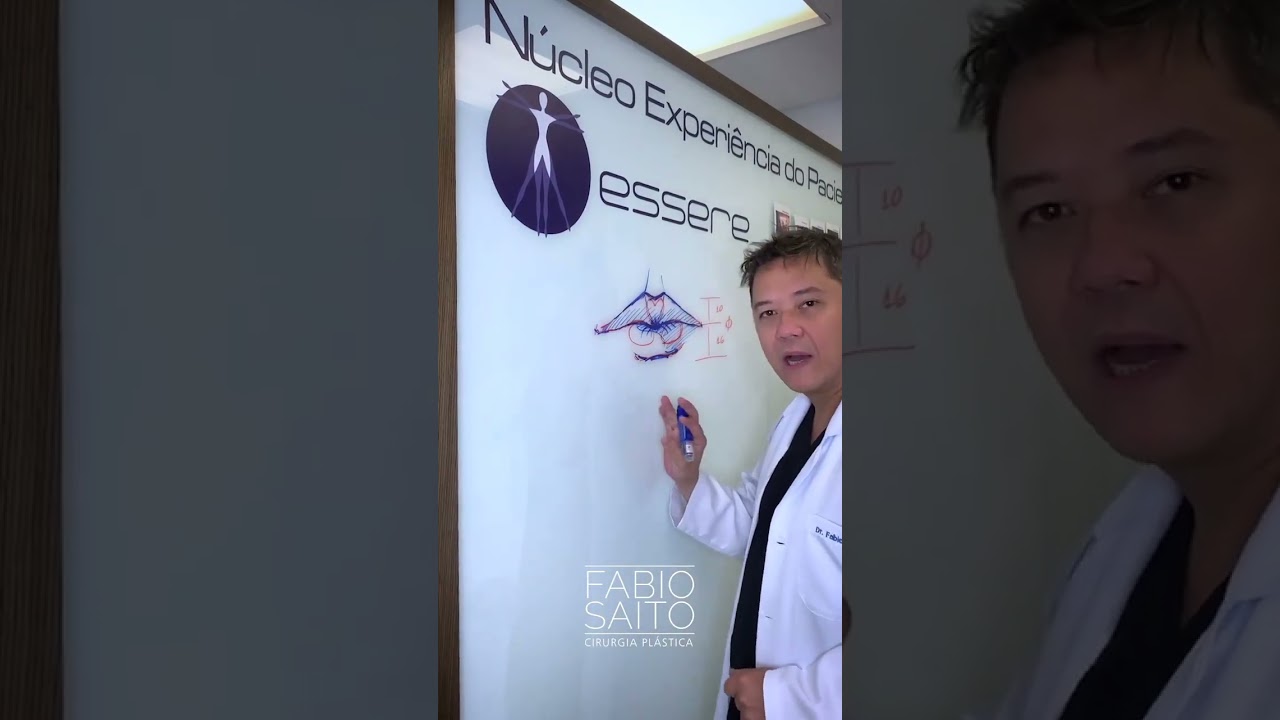 Why is it so difficult to get beautiful lip fillers? #lipfillers #facialharmonization