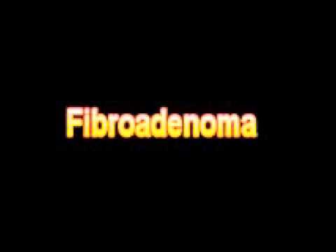 What Is The Definition Of Fibroadenoma - Medical Dictionary Free Online