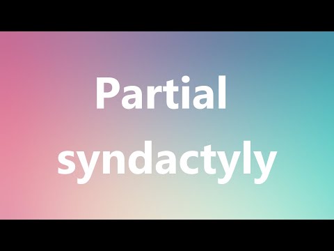 Partial syndactyly - Medical Definition and Pronunciation