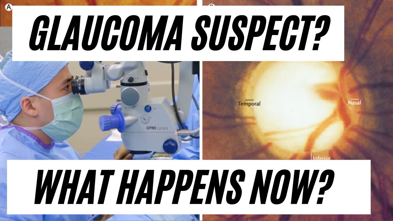 Glaucoma Suspect? What Does It Mean? Learn From Board Certified Eye Surgeon // Your Eyes Tell