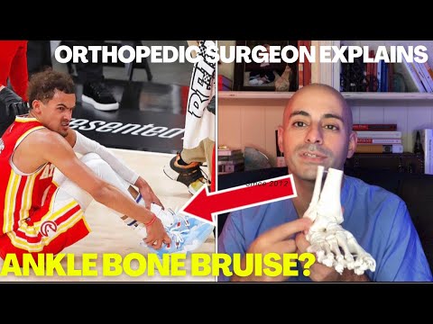 šTrae Young Ankle āBONE BRUISEā Explained by Orthopedic Surgeonš·