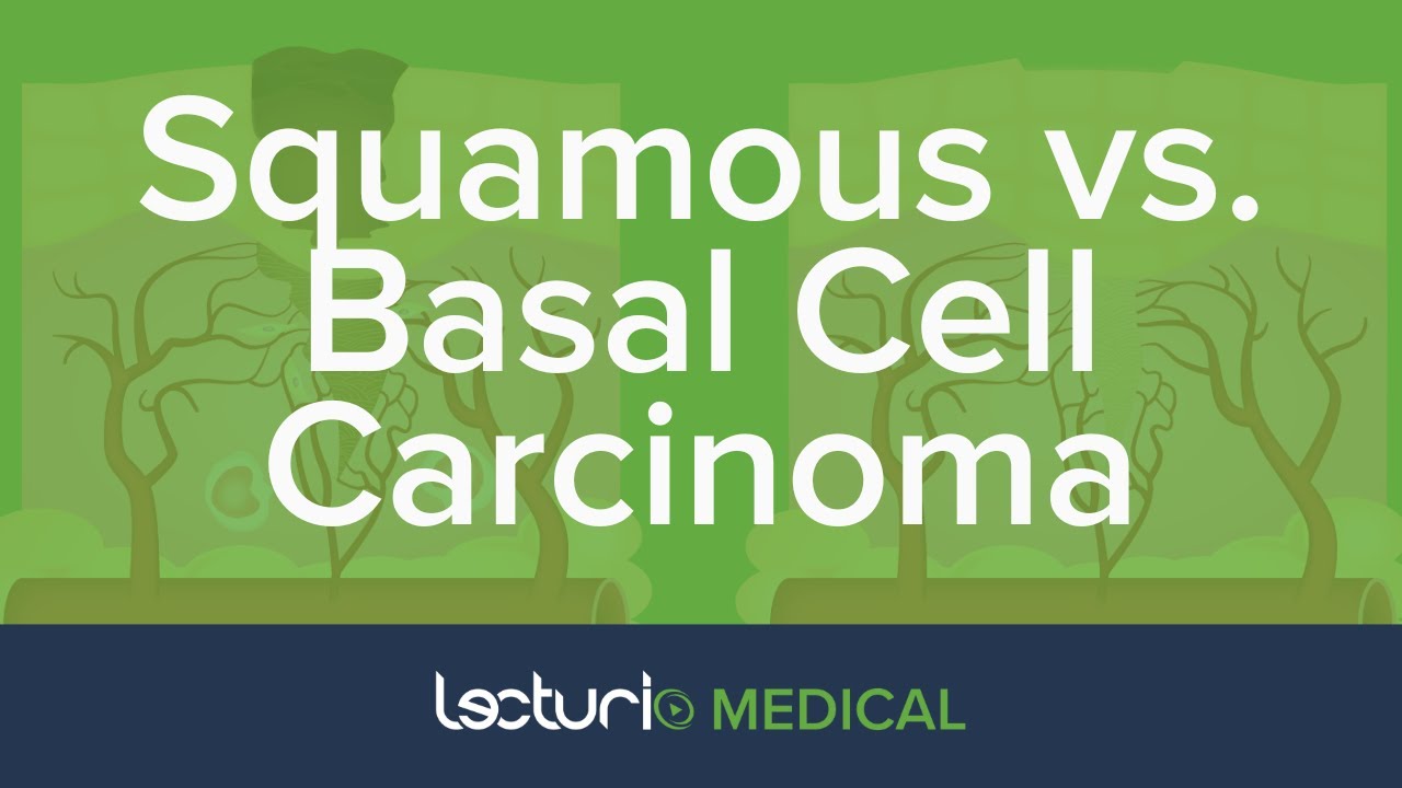 Squamous Cell Carcinoma (SCC) vs. Basal Cell Carcinoma (BCC) | Dermatology