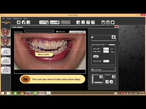 Smart Smile Design - Design Extras (Part 1)