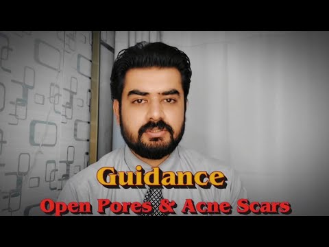 Acne Scars & Open Pores - Urdu | Hindi