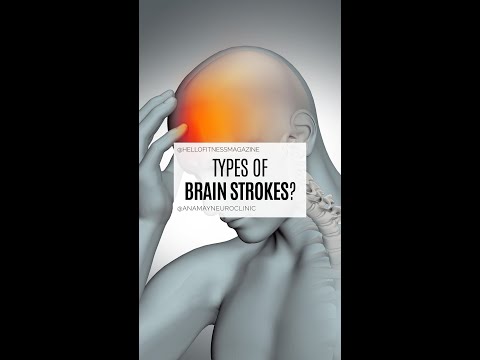 Types of stroke