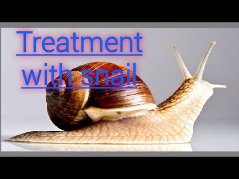 Facts of snails in Urdu/ Hindi by technical channel by hamza