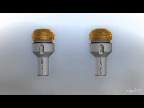 ACP-Autologous Conditioned Plasma