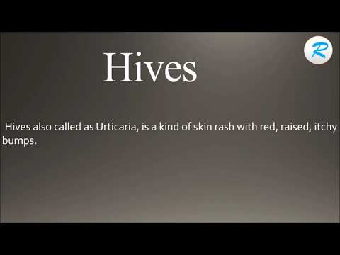 How to pronounce Hives