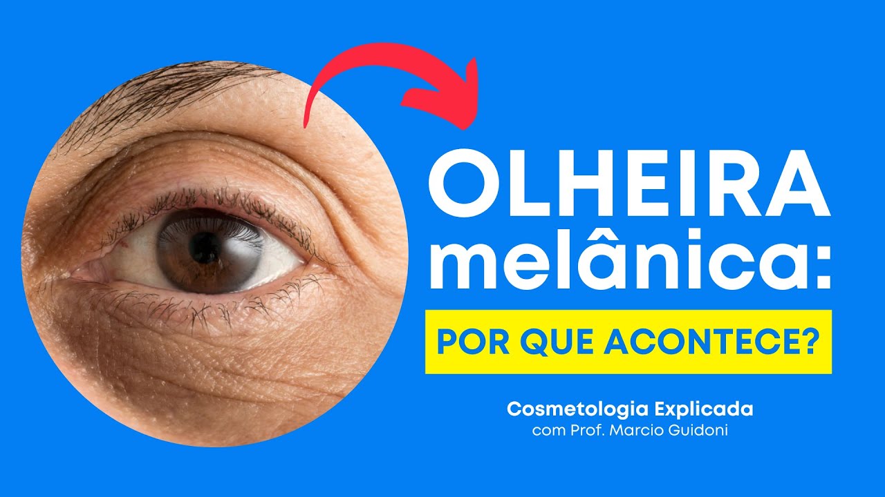 OLHEIRA MELÂNICA: O QUE É? | Cosmetologia Explicada com Prof. Marcio Guidoni