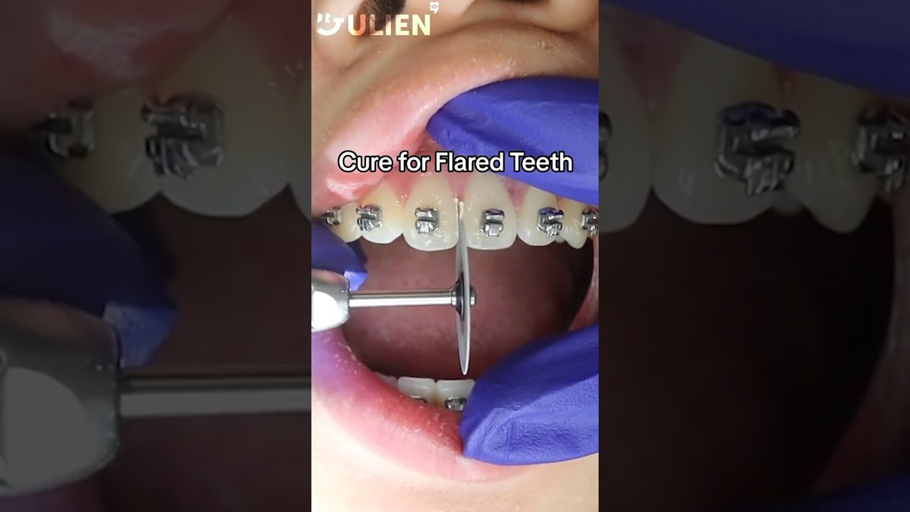 If This Ever Happens To You, This Is What You NEED To Know!