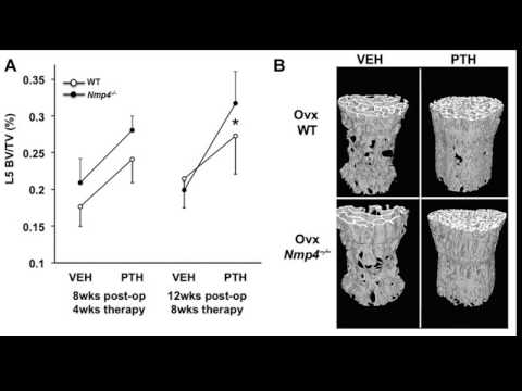 Paul Childress: The Nmp4 anti-anabolic axis