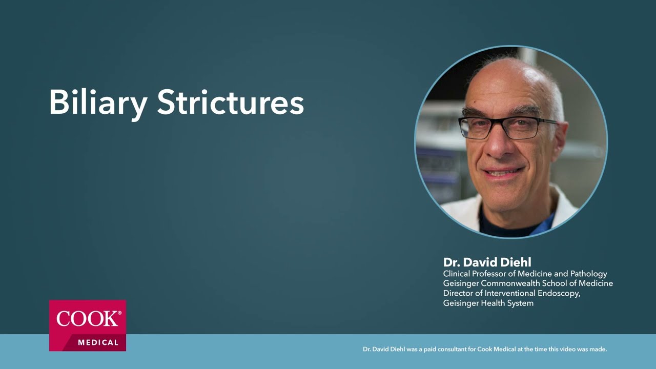 Overview of Biliary Strictures