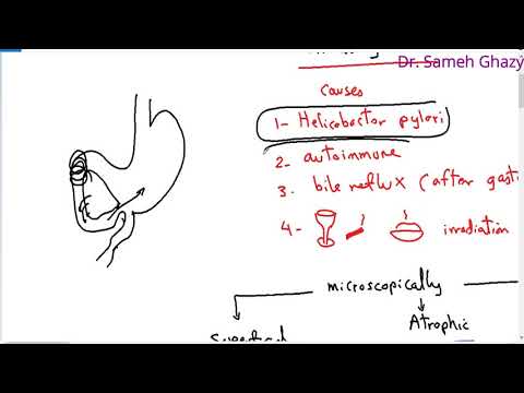 شرح Systemic pathology 22 GIT 3 gastritis DR SAMEH GHAZY معتمد - منصة معارف