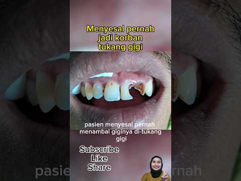 TAMBAL GIGI DEPAN YANG TINGGAL SEDIKIT