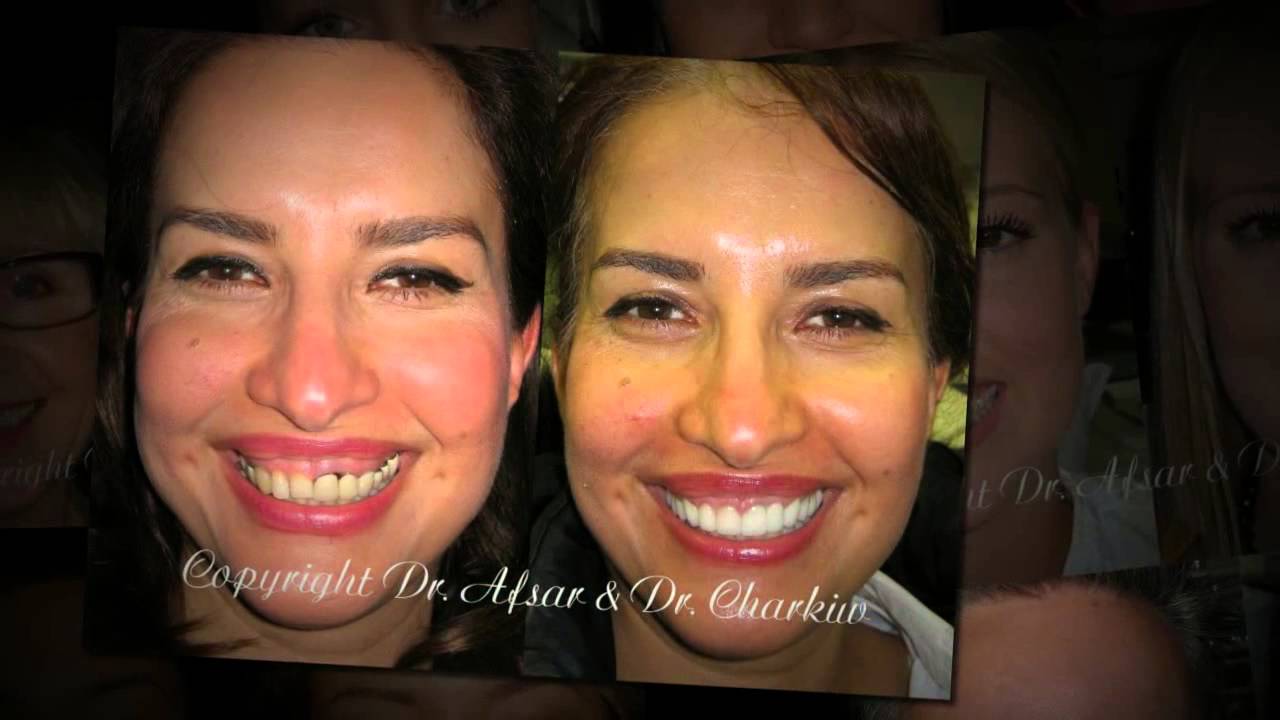 Toronto Smile Gallery by Drs. Charkiw and Afsar