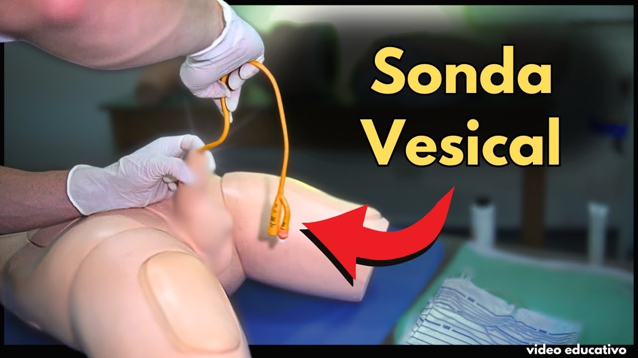 Urinary Catheter Placement in Men and Women: A Complete Guide