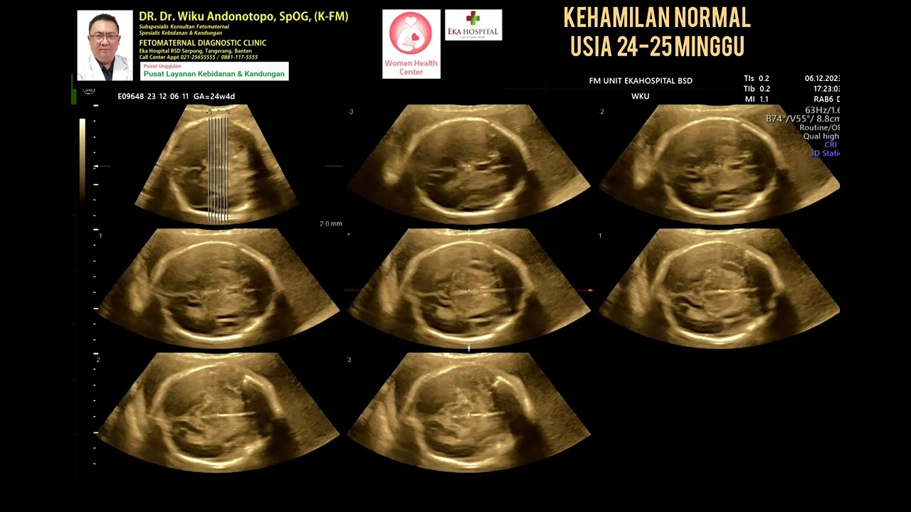 24-25 weeks pregnant
