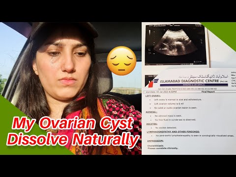 My Ovarian Cyst Dissolve Naturally | Natasha waqas vlog