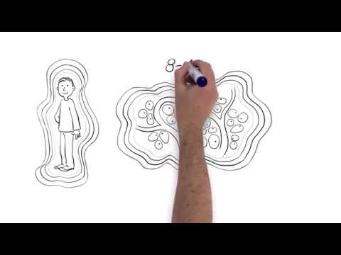 Matrix Therapy Equipment - Matrix Rhythm Therapy Matrixmobil Wholesale ...