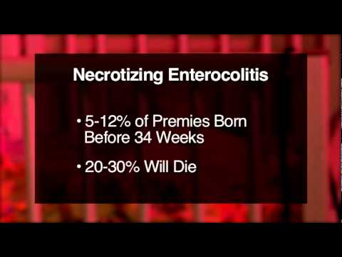 STOPPING NEC IN THE NICU