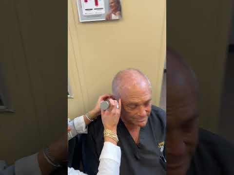Custom-fit Hearing Protection