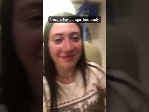 Facial Plastic Surgeon NYC | Dr. Sam Rizk