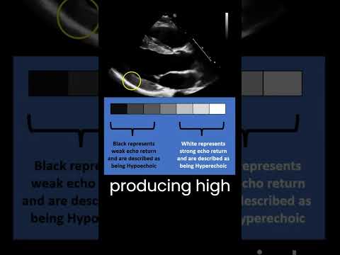 POCUS Basics: Echogenicity