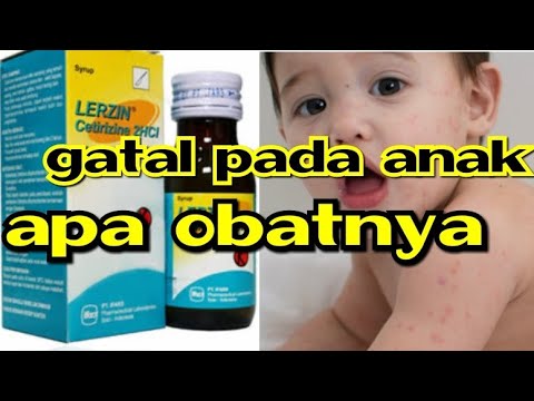 Obat gatal alergi maupun penyebab bakteri pada anak lerzin sirup
