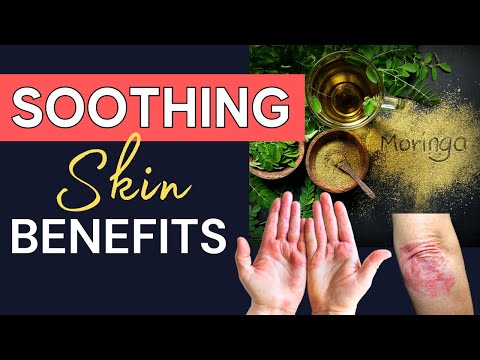 INCREDIBLE Moringa Oil Skin Benefits For RASHES Like Eczema & Psoriasis