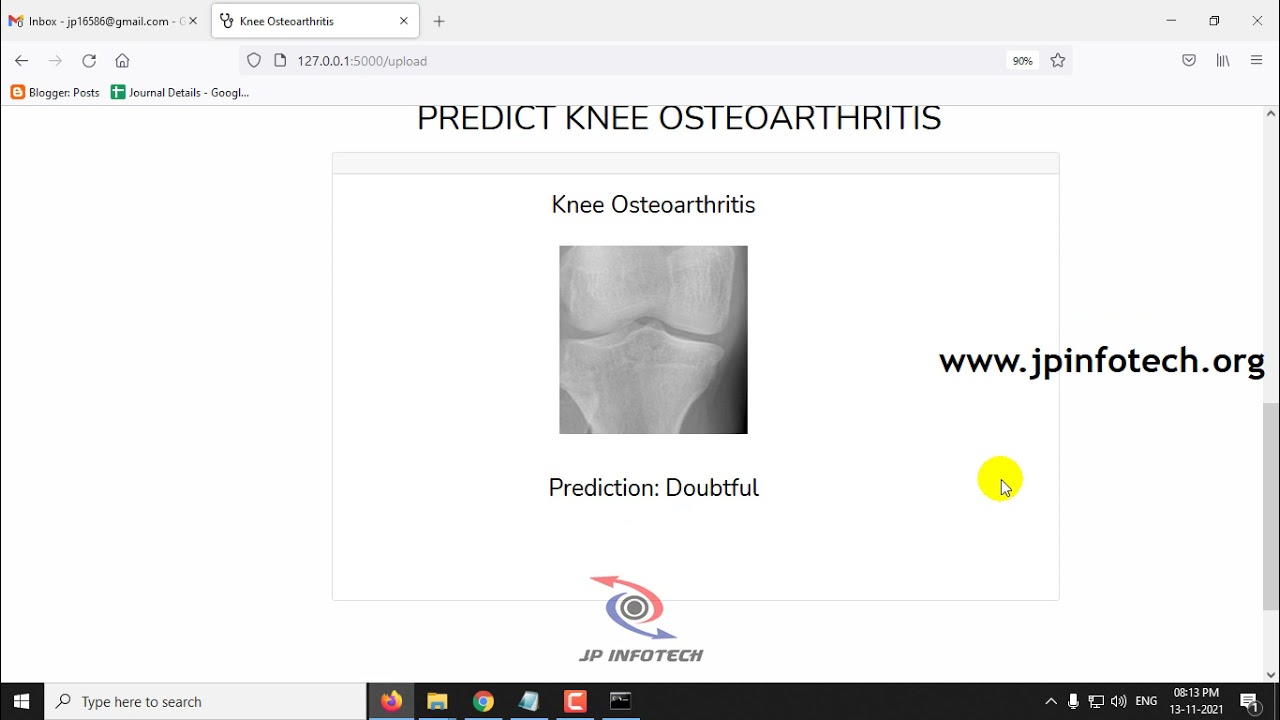 A Novel Method to Predict Knee Osteoarthritis using Deep Learning | Python Final Year Project