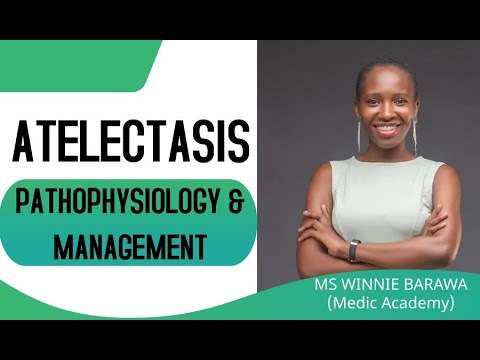 ATELECTASIS |DEFINITION |TYPES | MANAGEMENT | IS ATELECTASIS REVERSIBLE? FIND OUT