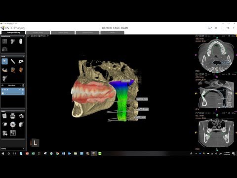 CS 9600 CBCT