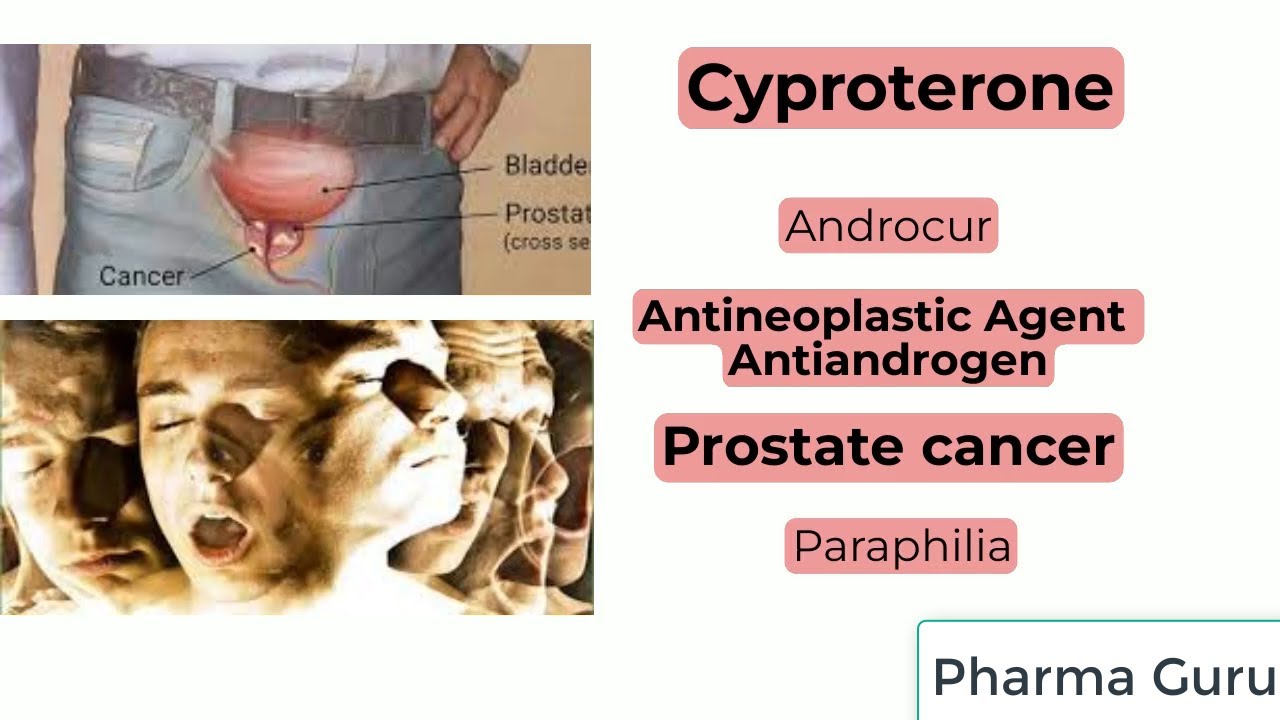 Cyproterone - Androcur - In a nutshell.