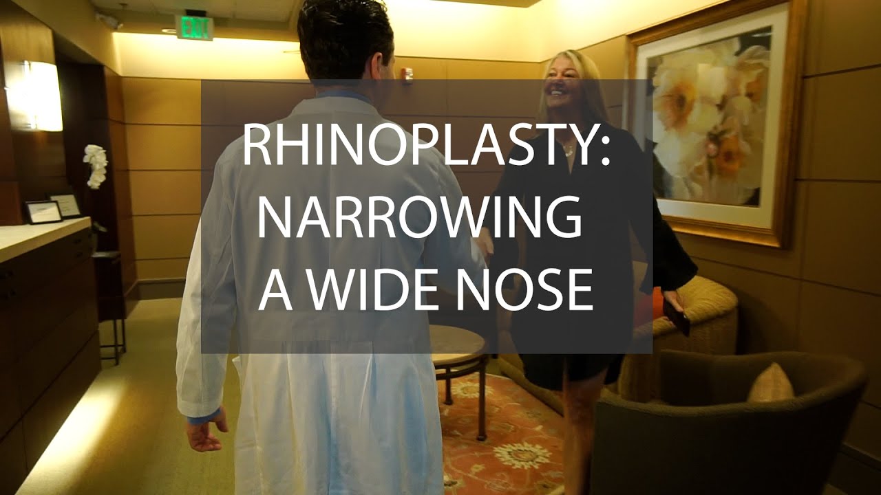 Rhinoplasty - Narrowing A Wide Nose