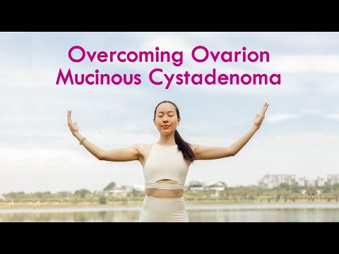Sharing My Journey with Benign Mucinous Cystadenoma - Diagnosis, Surgery, Laparotomy and Recovery