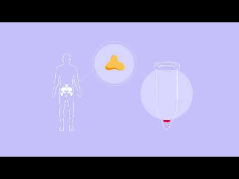 Myeloid Molecular Testing