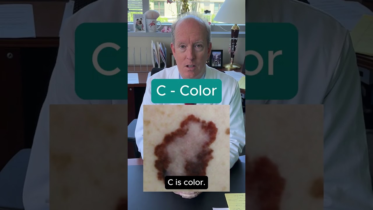 Is it a Mole or Melanoma?