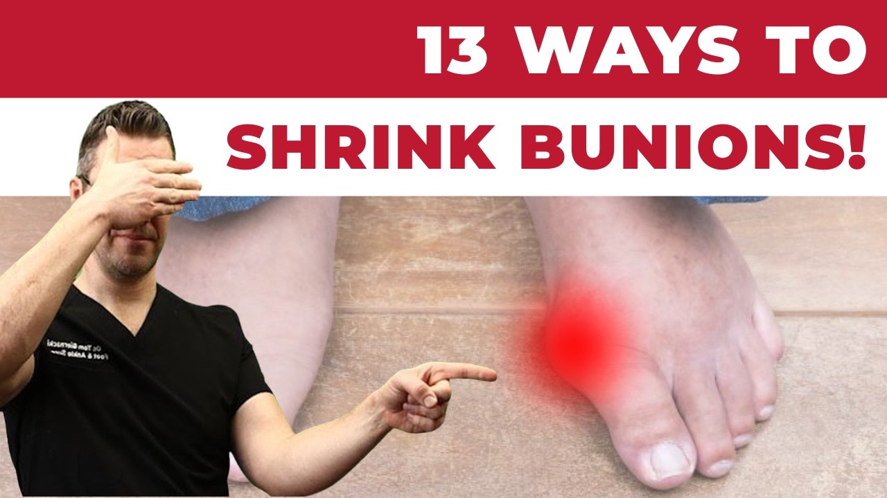 TOP 13 Ways to Shrink Bunions Naturally [+1 HUGE SECRET!]