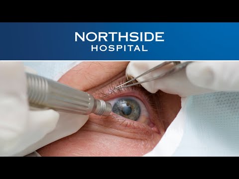 What You Need to Know About Cataracts With Dr. Reay Brown