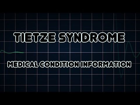 Tietze syndrome (Medical Condition)