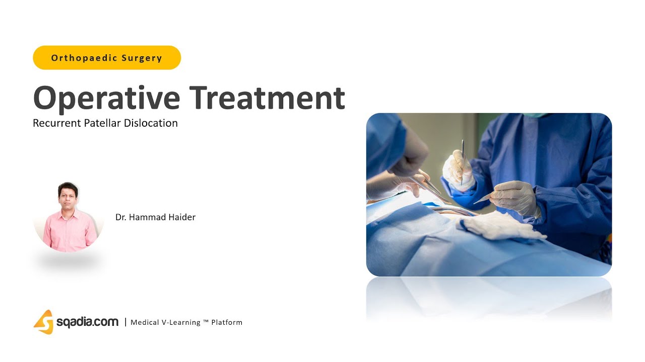 Recurrent Patellar Dislocation | Operative Treatment